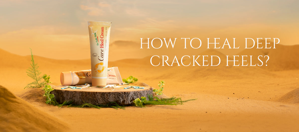 How to Heal Deep Cracked Heels? – Care Cosmetics Pakistan